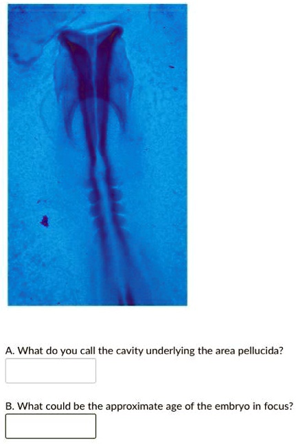 SOLVED: What do you call the cavity underlying the area pellucida? B ...