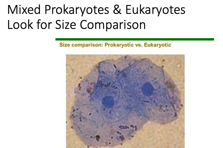 SOLVED: Mixed Prokaryotes Eukaryotes Look for Size Comparison Size ...