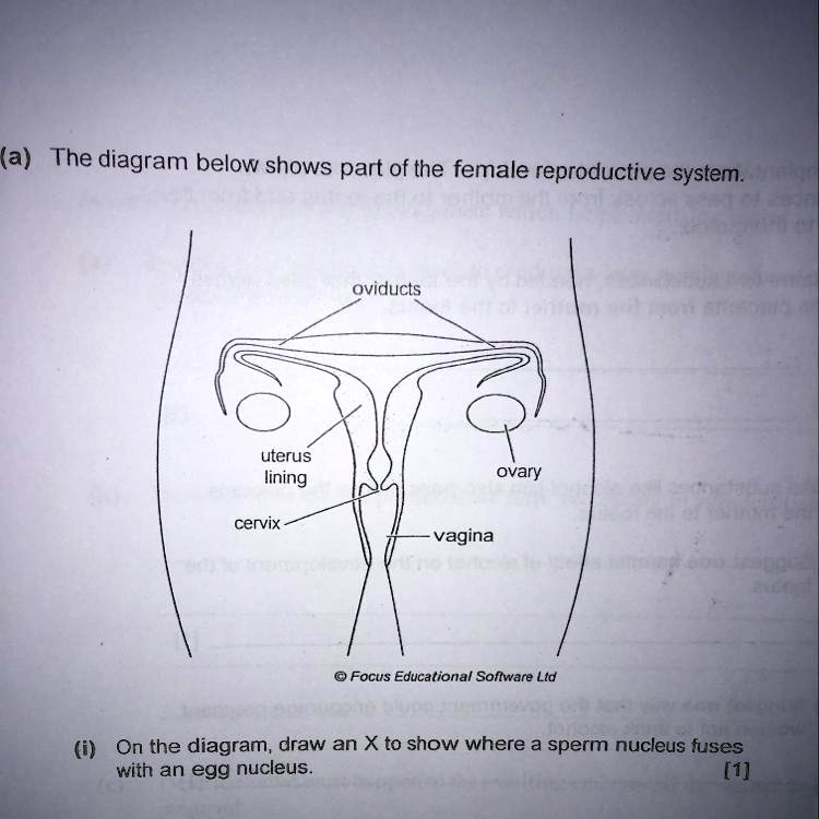a The Diagram Below Shows Part Of The Female Reproductive System a The Diagram Below Shows Part Of The Female Reproductive System