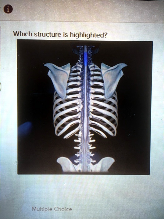 SOLVED: Which structure is highlighted? A. Sacral region B. Thoracic region C. Lumbar ...