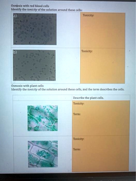 Osmosis with red blood cells Identify the tonicity of the solution ...