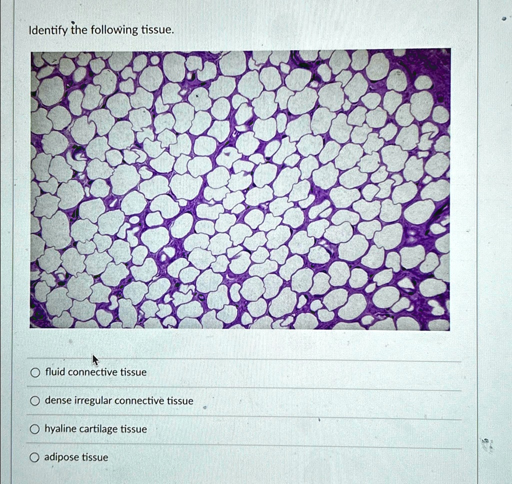 SOLVED: Identify the following tissue: - fluid connective tissue ... SOLVED: Identify the following tissue: - fluid connective tissue ...