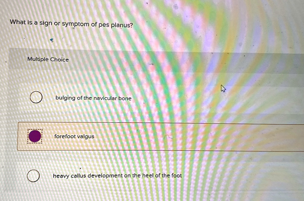 what is a sign or symptom of pes planus multiple choice bulging of the ...