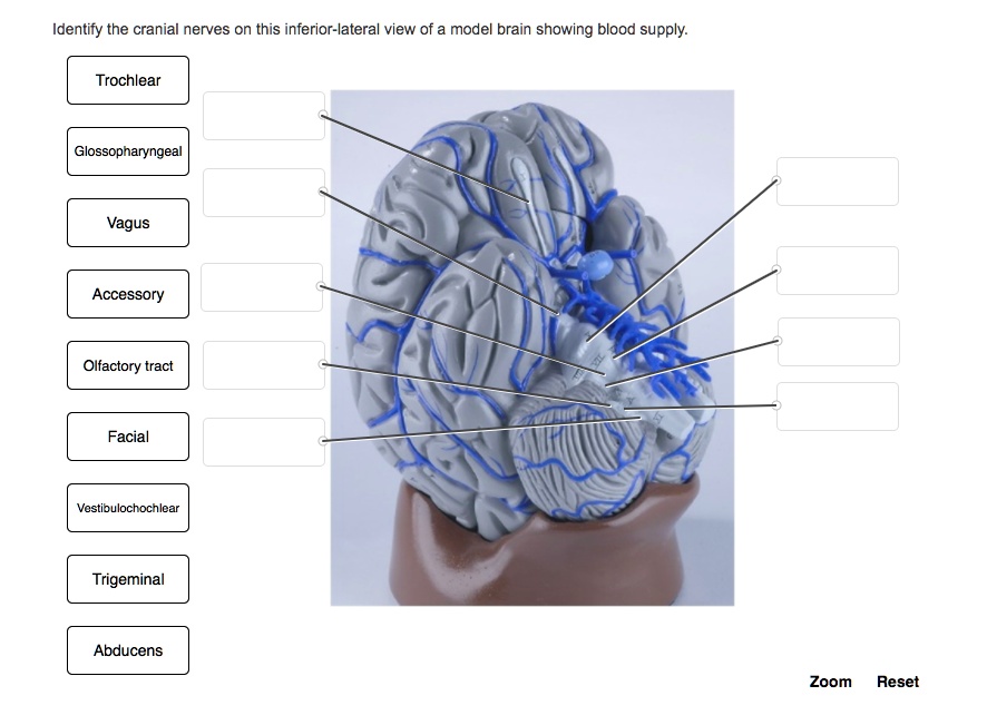 Identify the cranial nerves on this inferior-lateral view of a model ...