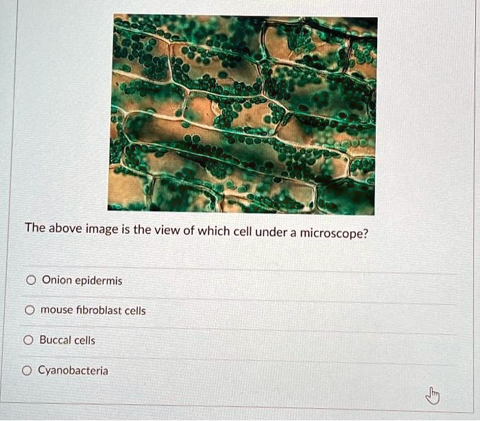 SOLVED: The above image is the view of which cell under a microscope ...