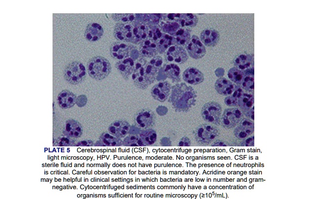 plate 5 cerebrospinal fluid csf cytocentrifuge preparation gram stain ...