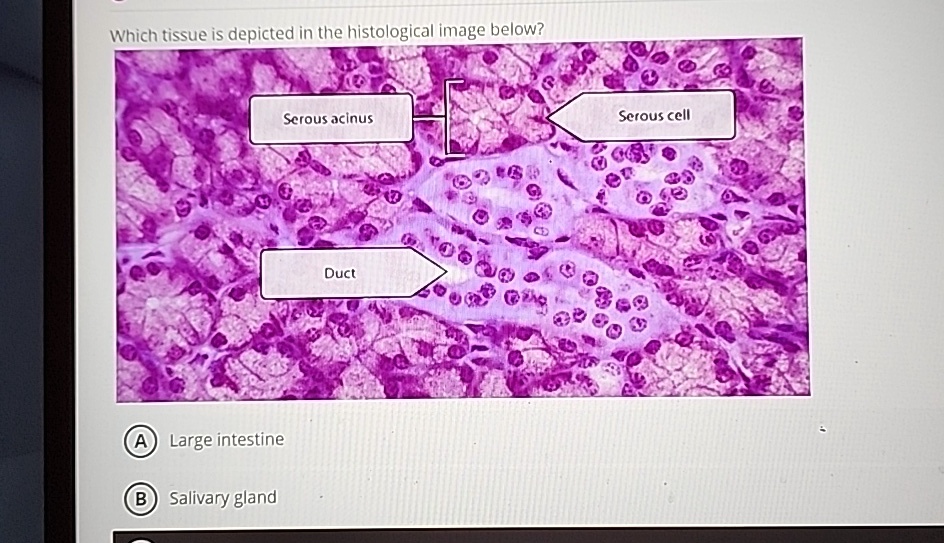 Which tissue is depicted in the histological image below? A Large ...
