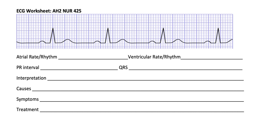 SOLVED: ECG Worksheet: AH2 NUR 425 Atrial Rate/Rhythm Ventricular Rate ...