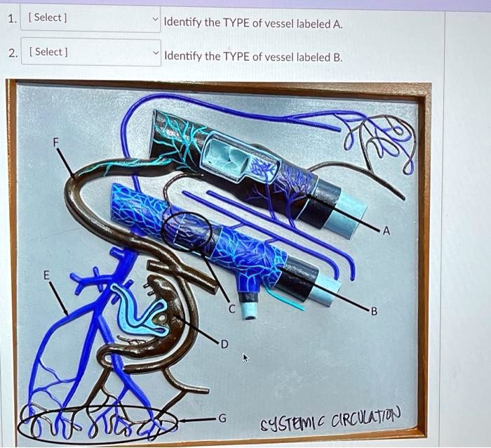 SOLVED: Identify the TYPE of vessel labeled A. Identify the TYPE of vessel labeled B. SYSTEMIC ...