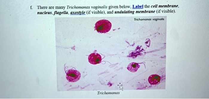 SOLVED: There are many Trichomonas vaginalis given below; Label the ...