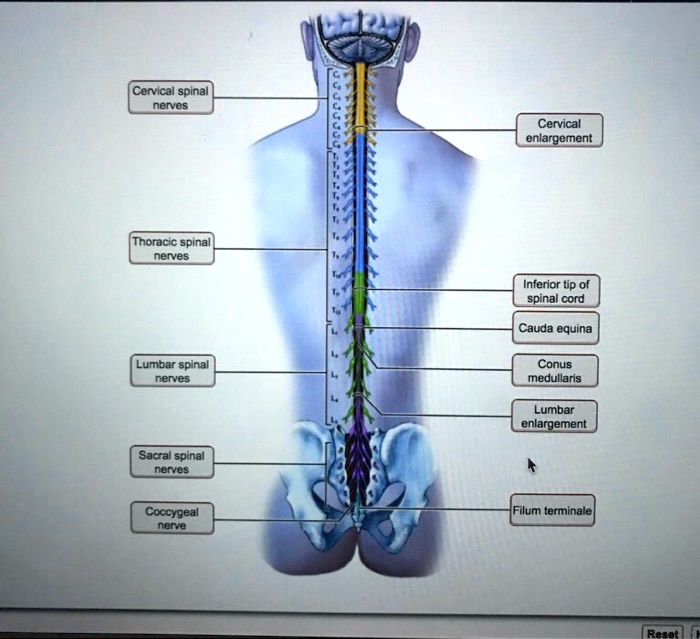 SOLVED:Cervical spinal nerves Cervical enlargement Thoracic spinal nenves Inferior tip of spina ...