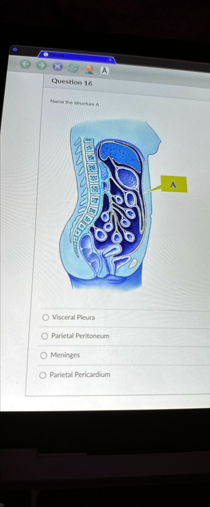 Question 16 Name the structure A Visceral Pleura Parietal Peritoneum ...