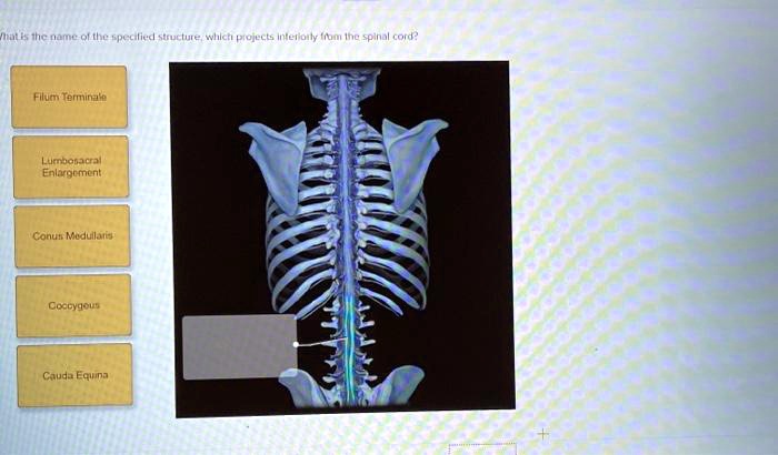 What is the name of the specified structure, which projects inferiorly ...