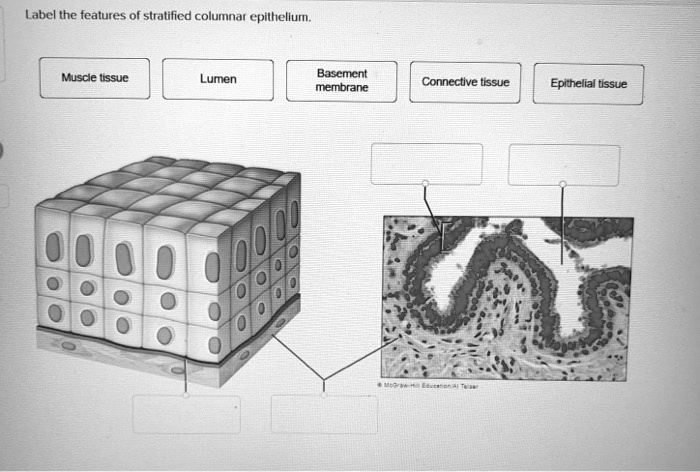 SOLVED: Label the features of stratified columnar epithelium Muscle tissue Lumen Basement ...