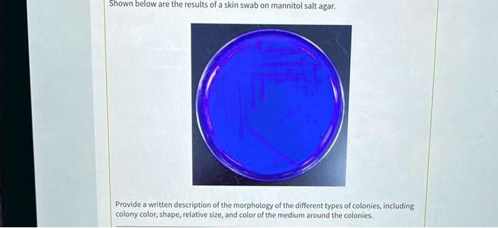 Shown below are the results of a skin swab on mannitol salt agar ...