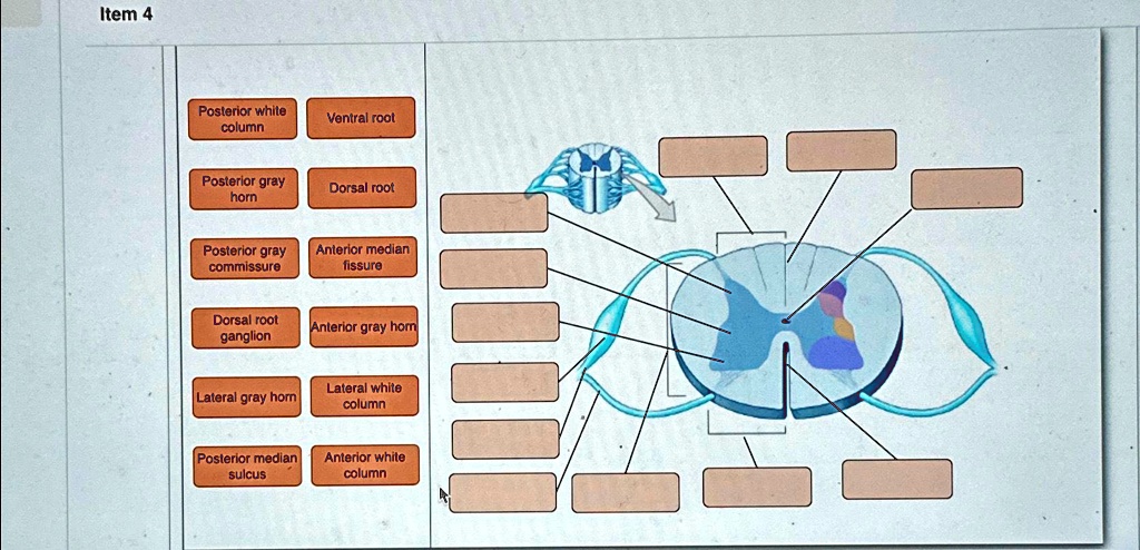 Item 4 Posterior white column Ventral root Posterior gray horn Dorsal ...