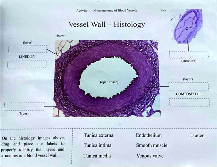 Artery (layer) LINED BY (layer) Activity 1 - Microanatomy of Blood ...