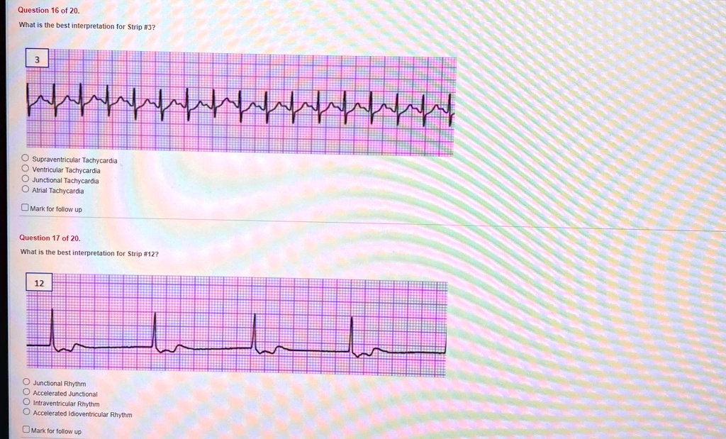 Question 16 of 20: What is the best interpretation for Strip #3 ...