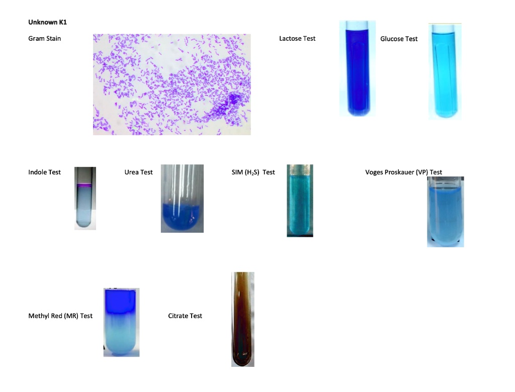 SOLVED: Gram Stain Lactose Test Glucose Test Indole Test Urea Test SIM ...