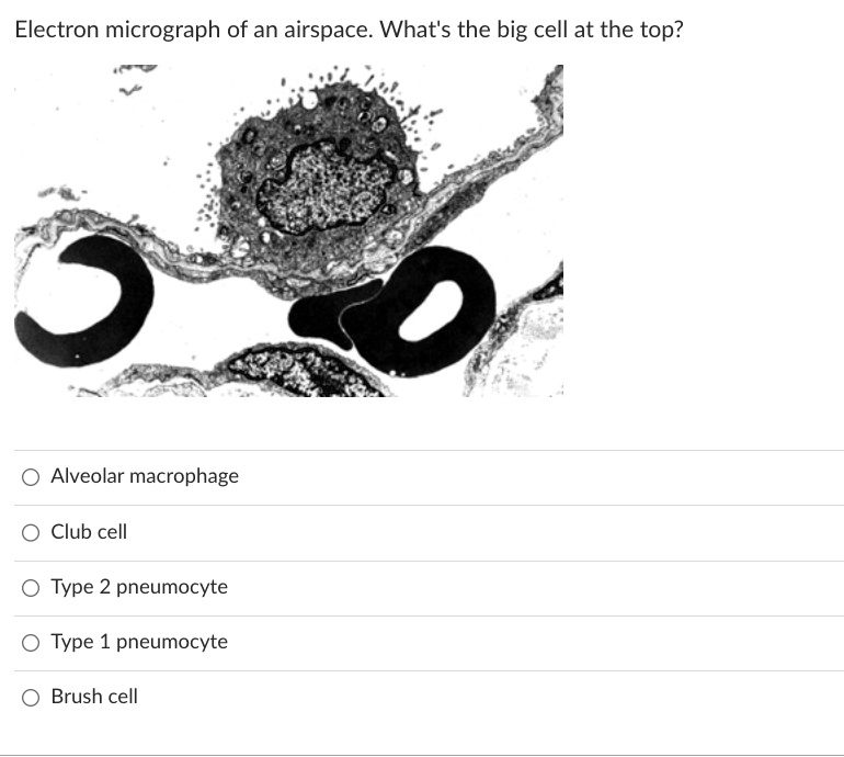 SOLVED: Texts: Not club nor brush cell Electron micrograph of an ...