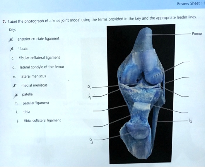 Review Sheet 11 7. Label the photograph of a knee joint model using the ...