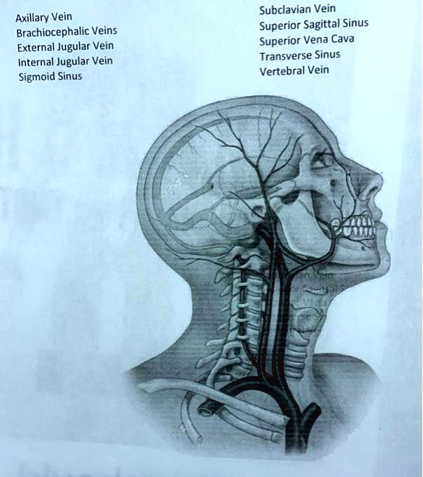 SOLVED: Subclavian Vein Superior Sagittal Sinus Superior Vena Cava ...