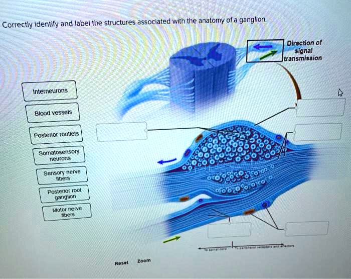Correctly identify and label the structures associated with the anatomy ...