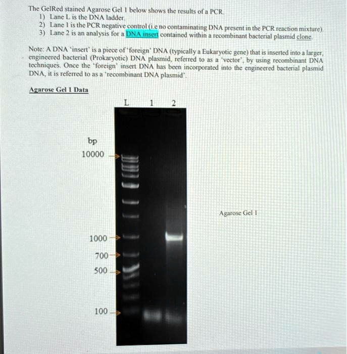 The GelRed stained Agarose Gel I below shows the results of a PCR. 1 ...