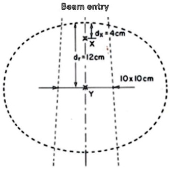 Beam entry dx = 4cm dr = 12cm 10 x 10cm