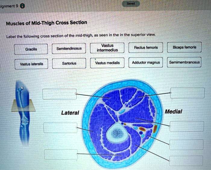 Muscles of Mid-Thigh Cross Section Label the following cross section of ...