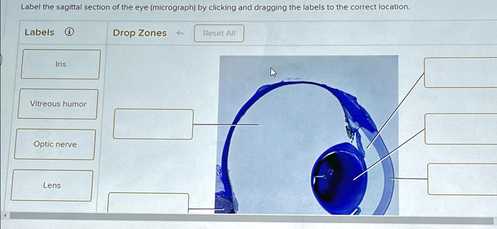 Label the sagittal section of the eye (micrograph) by clicking and ...