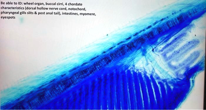 SOLVED: Be able to identify: wheel organ, buccal cirri, chordate ...