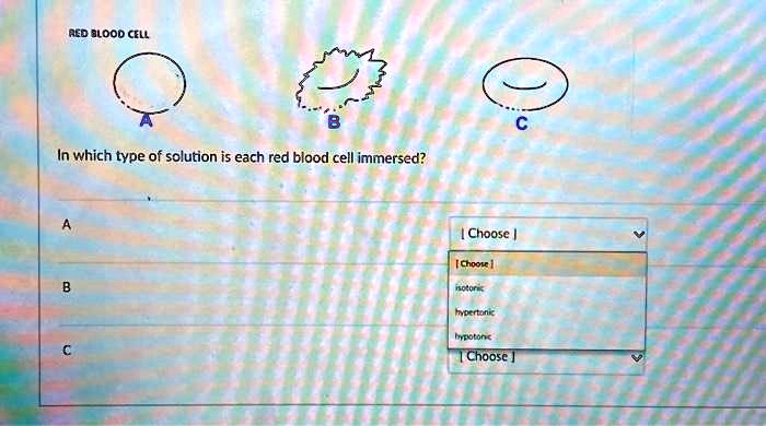 SOLVED: Texts: RED BLOOD CELL In which type of solution is each red ...