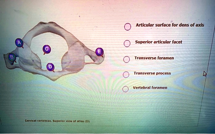 Articular surface for dens of axis Superior articular facet Transverse foramen Transverse ...