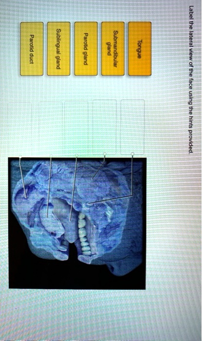 SOLVED: Parotid duct Sublingual gland Parotid gland gland Submandibular ...