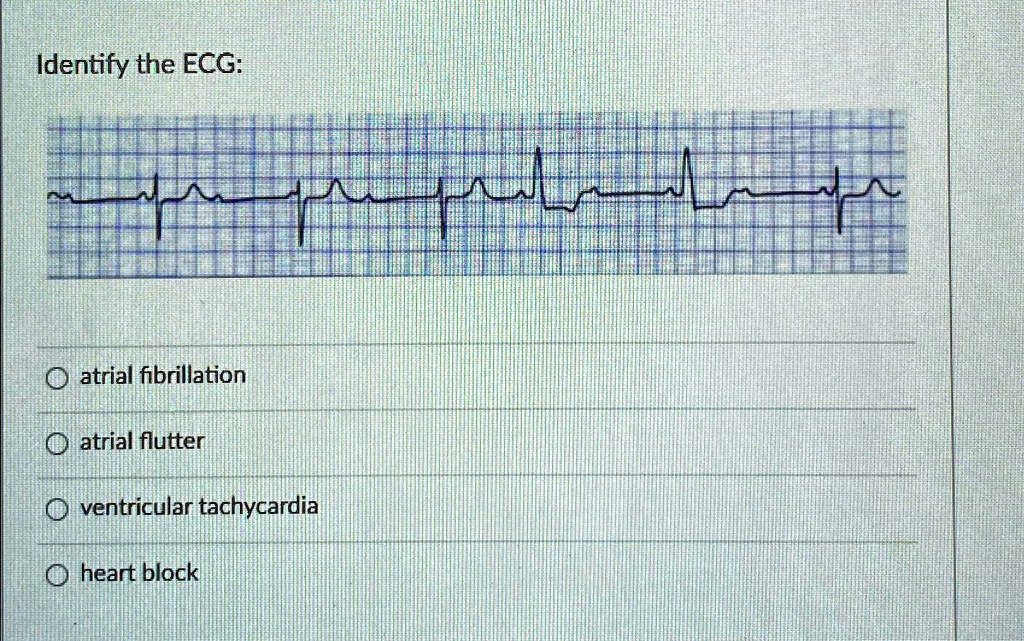Identify the ECG: atrial fibrillation atrial flutter ventricular ...