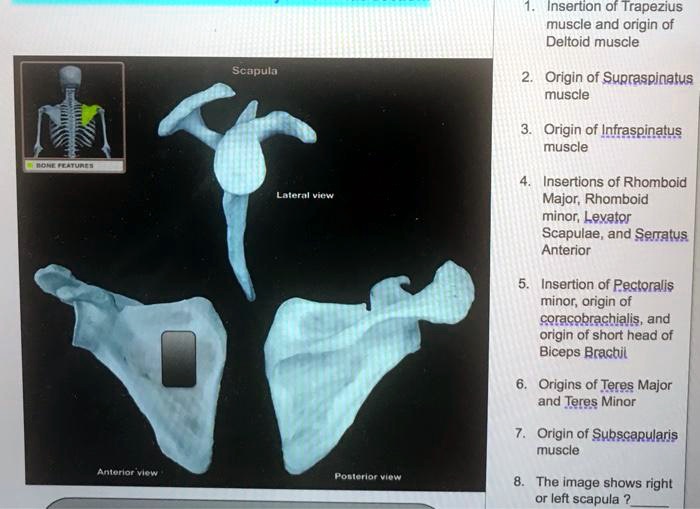 SOLVED: Insertion of Trapezius muscle and origin of Deltoid muscle ...