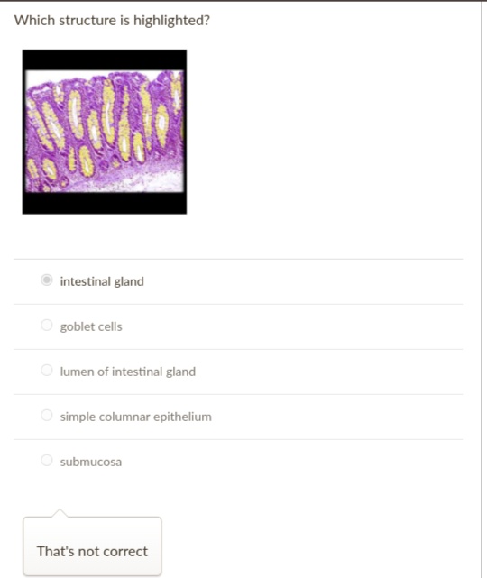 Which structure is highlighted? intestinal gland goblet cells lumen of ...