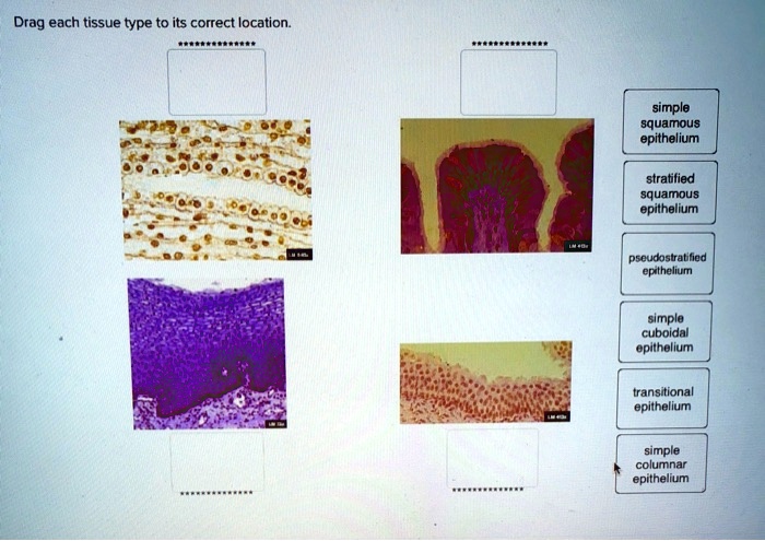 Drag each tissue type to its correct location ...