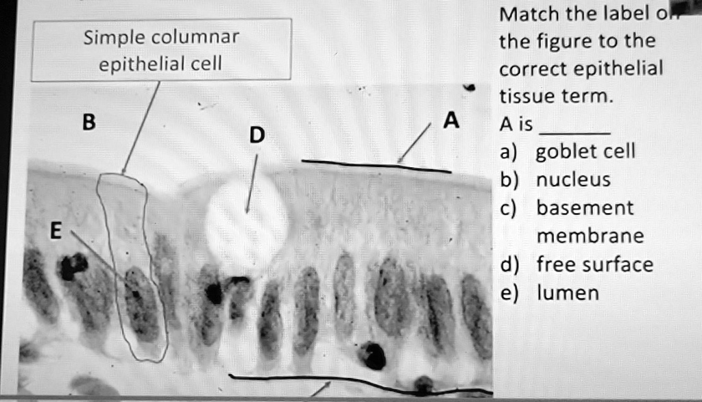SOLVED: Match the label to the figure to the correct epithelial tissue term. A is a) goblet cell ...