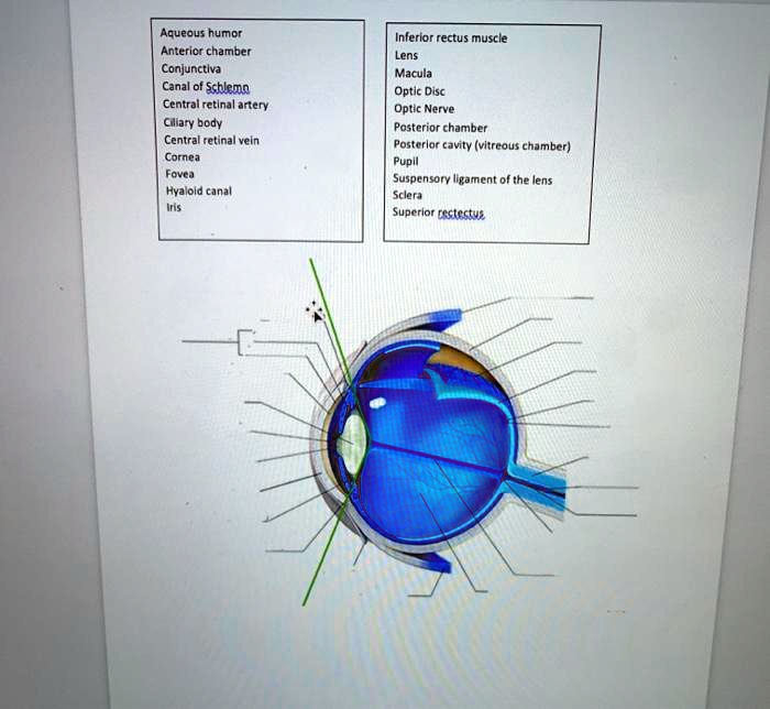SOLVED: Aqueous humor Anterior chamber Conjunctiva Canal of Schlemm ...