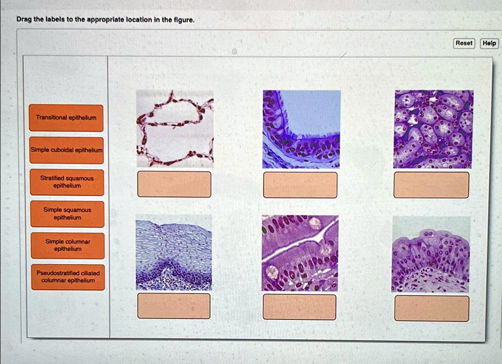 SOLVED: Drag the labels to the appropriate location in the figure. Reset Help Transitional ...