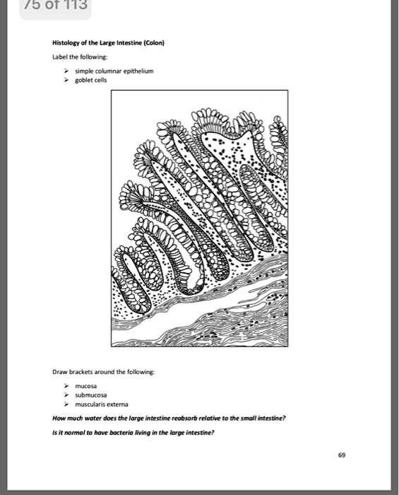 Histology of the Large Intestine (Colon) Label the following: ? simple ...