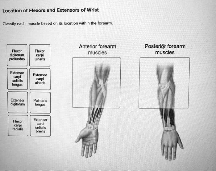 Location of Flexors and Extensors of Wrist Classify each muscle based ...