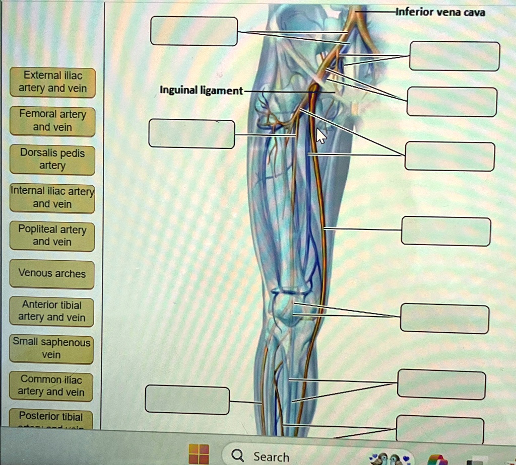 please label image correctly inferior vena cava external iliac artery ...