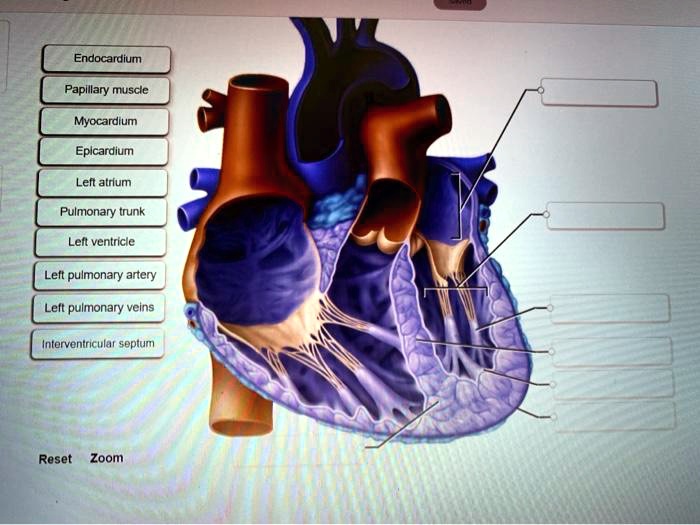 Endocardium Papillary muscle Myocardium Epicardium Left atrium ...