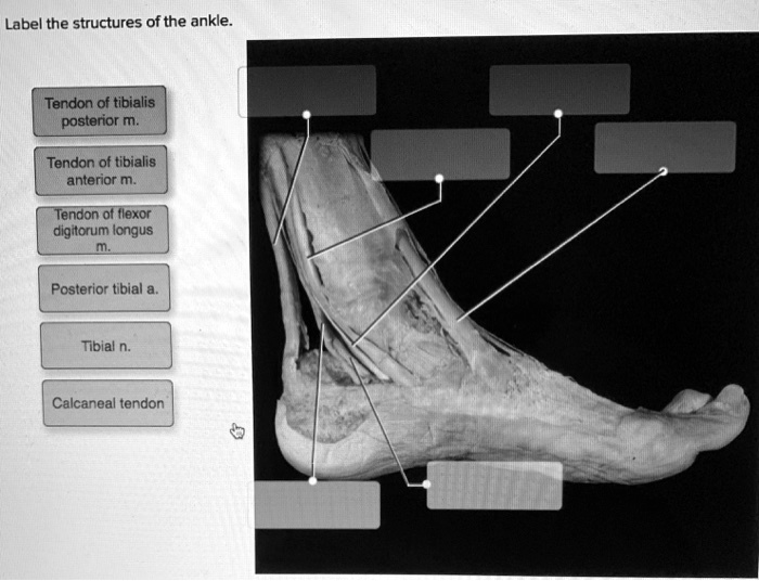 SOLVED: Label the structures of the ankle Tendon of tibialis posterior ...