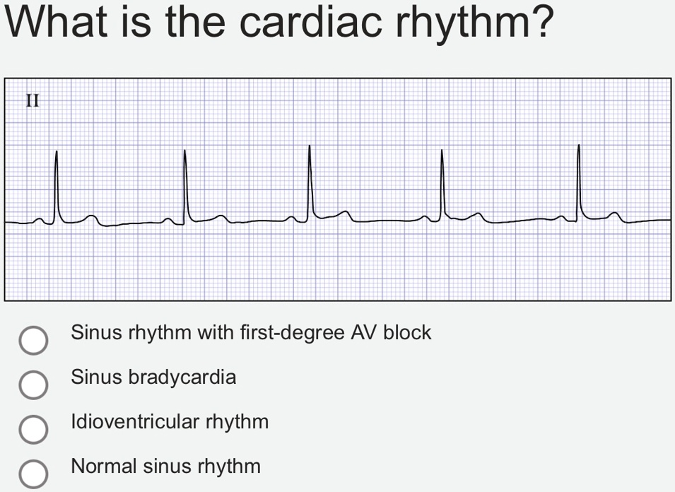 what is the cardiac rhythm shown in the ekg strip choose between the ...