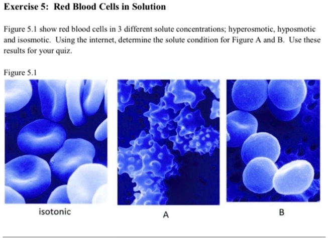 SOLVED: Exercise 5: Red Blood Cells in Solution Figure show red blood ...