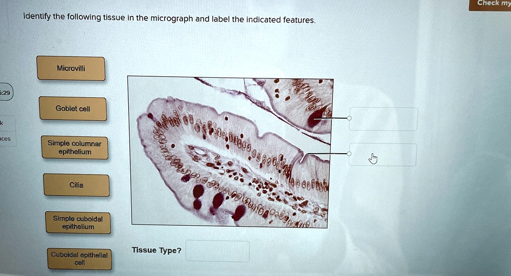 529 ces identify the following tissue in the micrograph and label the indicated features ...
